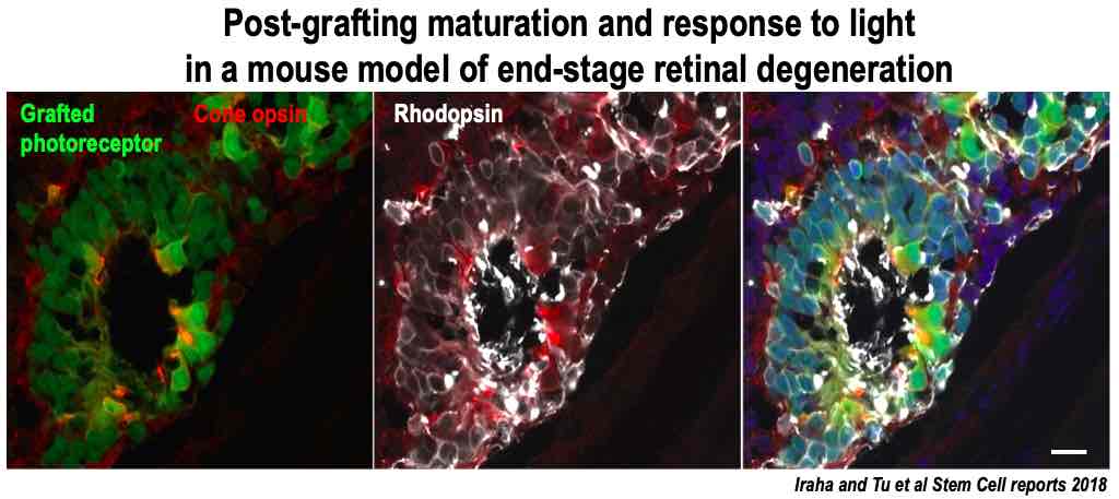 Groundbreaking Organoid Vision Trial: Takahashi Q&A - The Niche