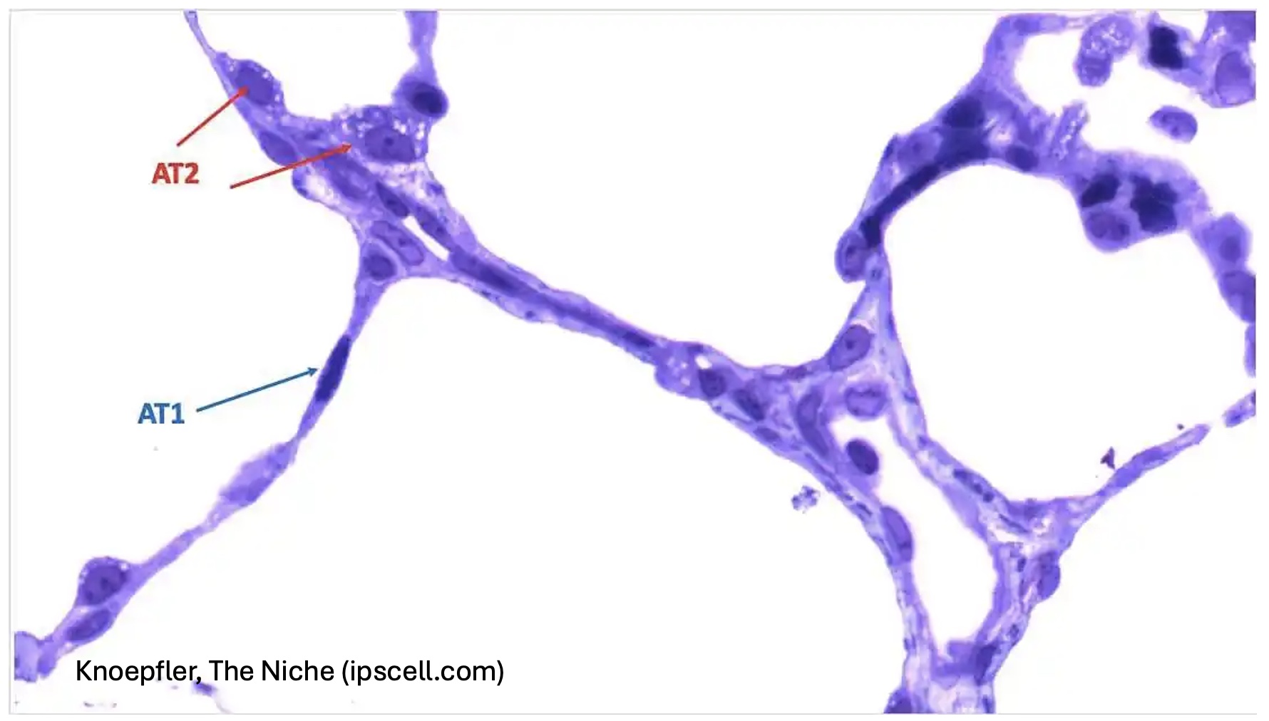 Recommended reads: lung stem cells, Utah stem cell law, Ozzy gets cells ...